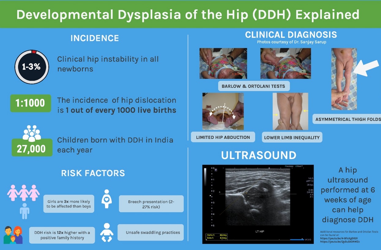 DDH Care Pathway Survey | Indian Academy of Pediatrics (IAP)